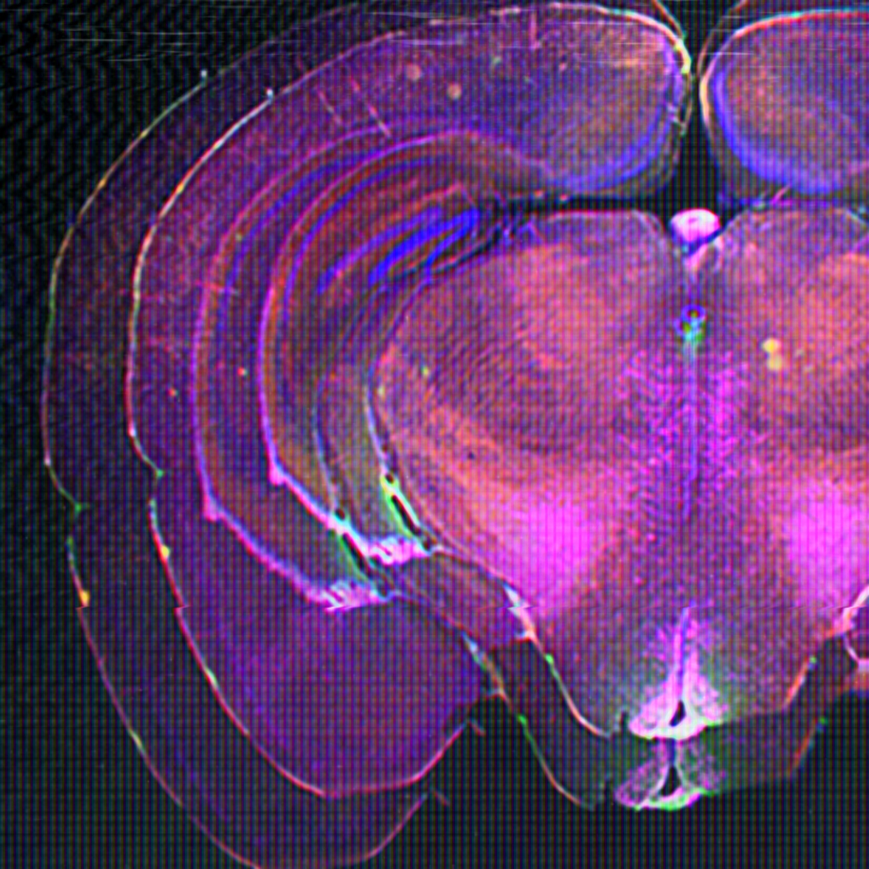Gender Mosaic Beyond The Myth Of The Male And Female Brain By Daphna